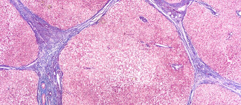 Fibrosis Imaging | DRS Daylight Solutions